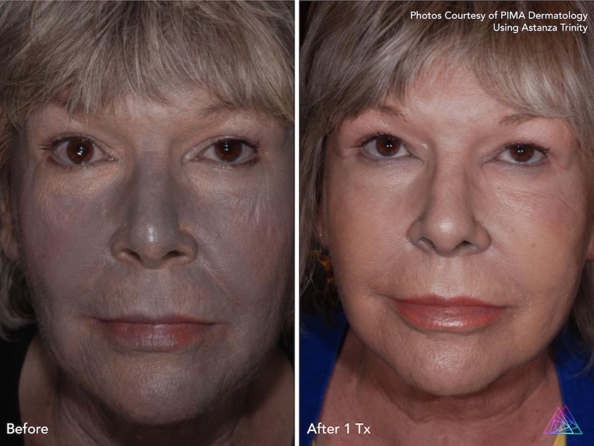Astanza’s 2022 Client-Only Before & After Photo Contest Winners